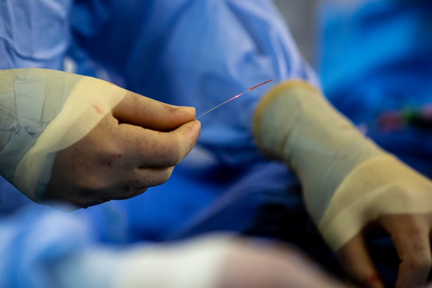 Breakthrough FFR Technology Aides in Interventional Stent Placement ...